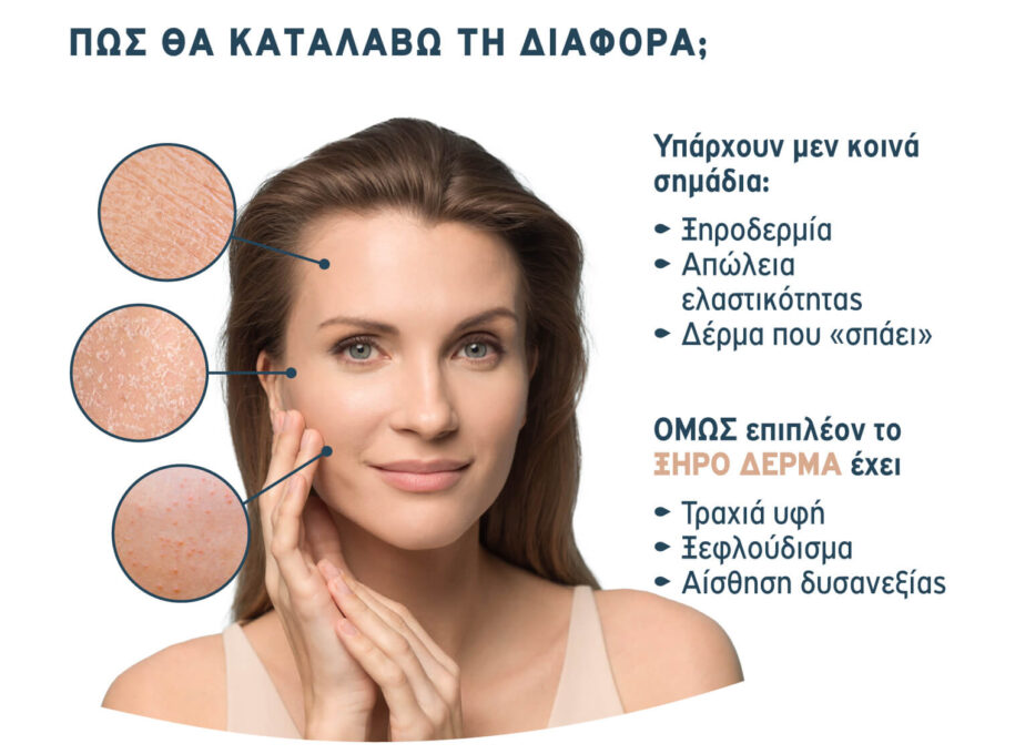 Ενυδάτωση Επιδερμίδας για Ξηρό και Αφυδατωμένο Δέρμα